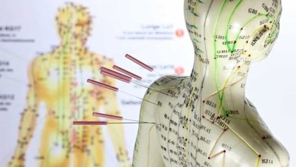 Acupuncture for Sciatica - Does it Really Work?